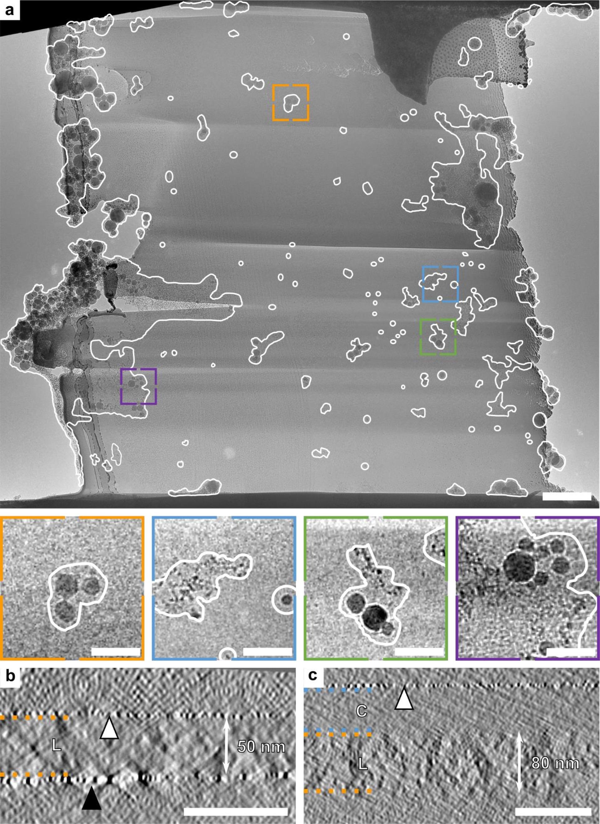 How to reduce contamination in Cryo-ET with advanced Cryo-FIB techniques